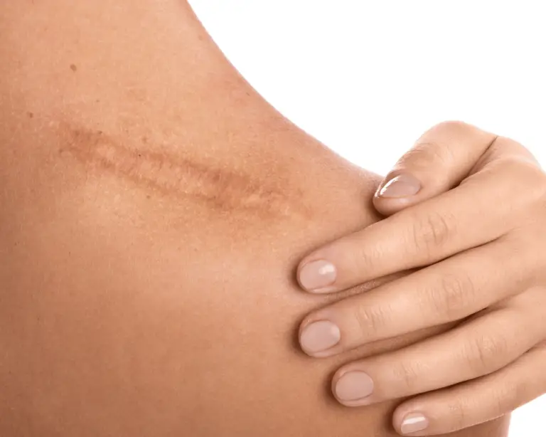 Healing Edges: Navigating Excellence in Surgical Incisions - The ...